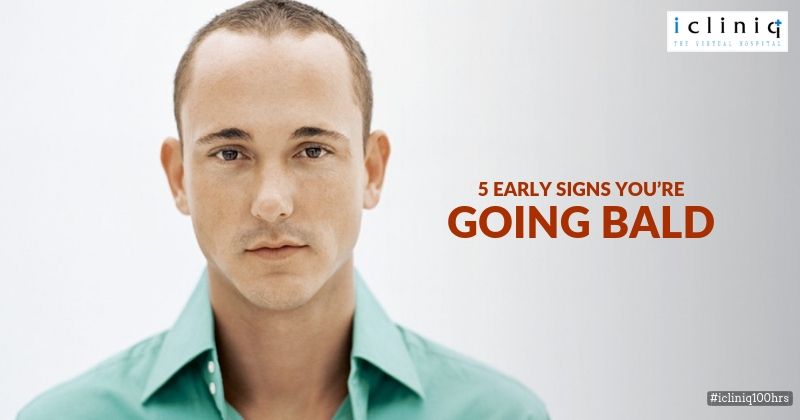 5 Early Signs You're Going Bald