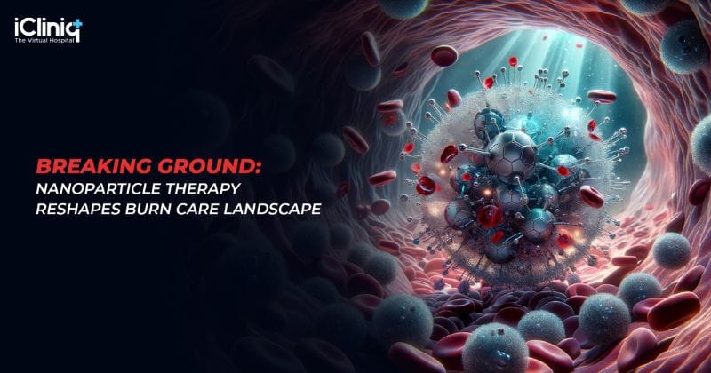 For Burn Victims, Is Nanoparticle Therapy a Boon?